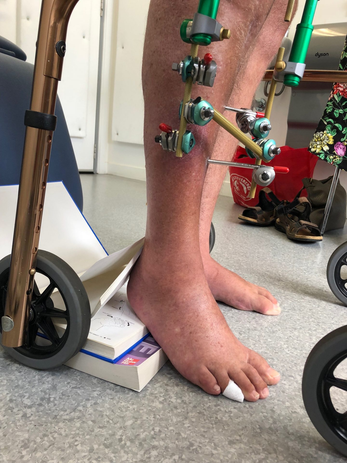 Pillar without correction