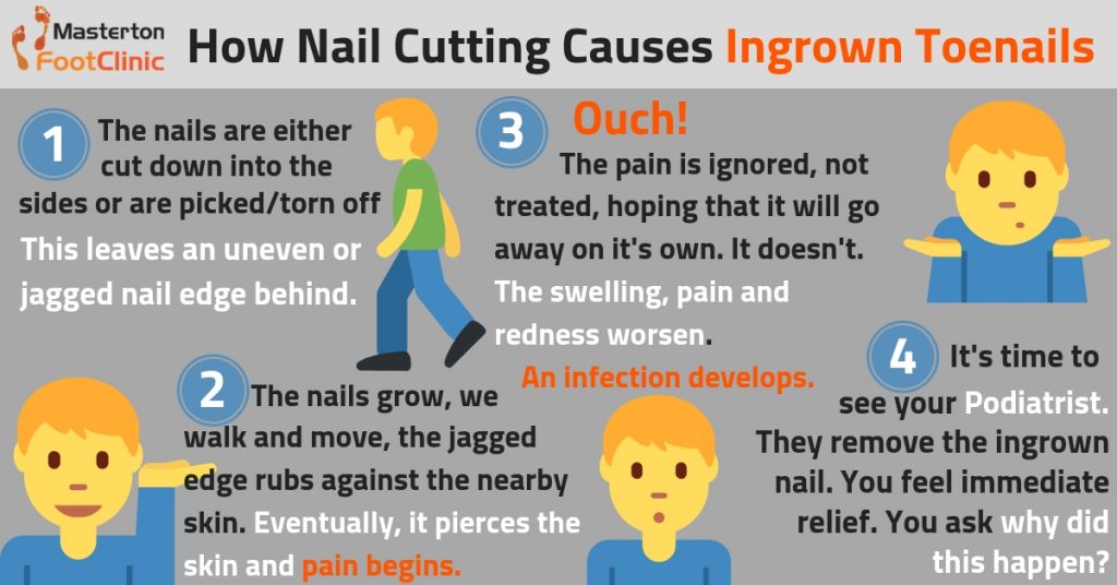 Ingrown Toenail Pain Relief, Treatment & Prevention |Masterton Foot Clinic