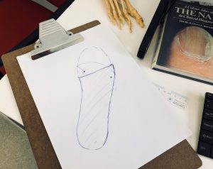 The One Easy & Simple Solution For In-toeing: The Gait Plate ...