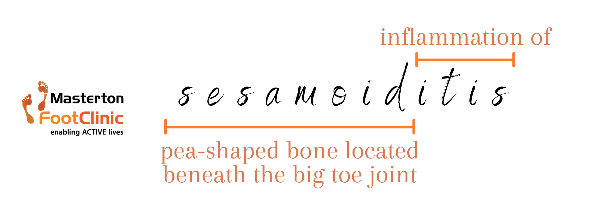 Sesamoiditis - Masterton Foot Clinic