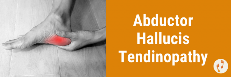 Abductor Hallucis Tendinopathy - Masterton Foot Clinic