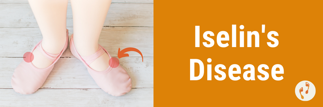 Iselin's Disease - Masterton Foot Clinic